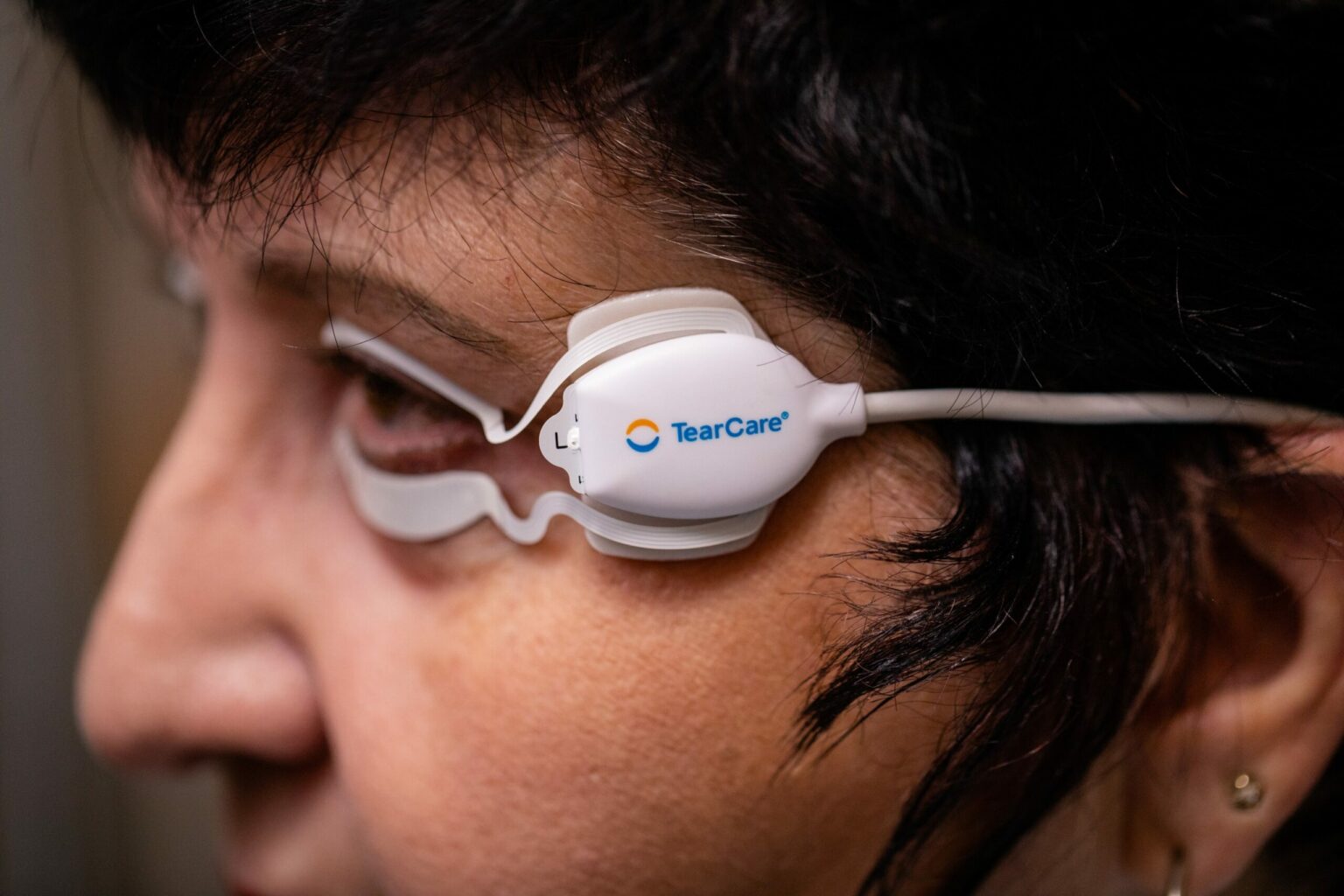 TearCare® Dry Eye Treatment System l Innovative Eye Care